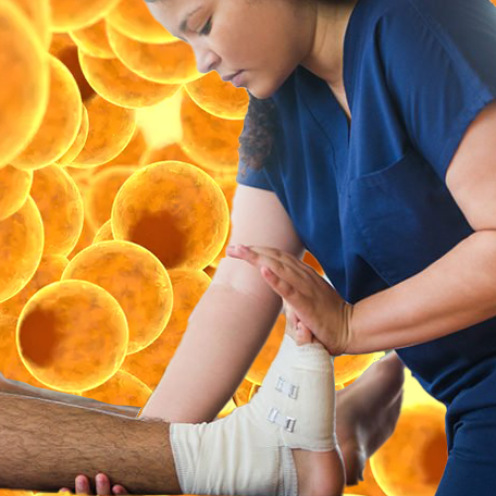 Regen.Sports.Med_.microfat-copy.png