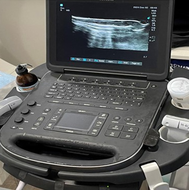 SonoSite-ultrasound-machine-.jpg